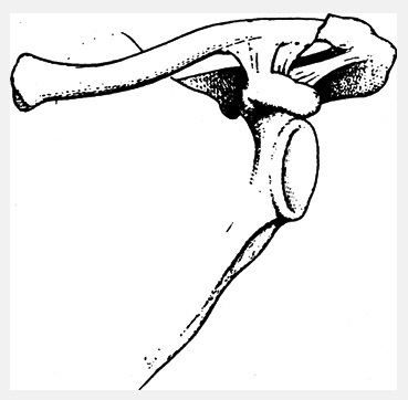 Esa Unggul Physical Therapy: Clavicle Fractures