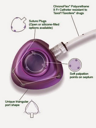 Star-fishing: Portacath, First Chemo treatment