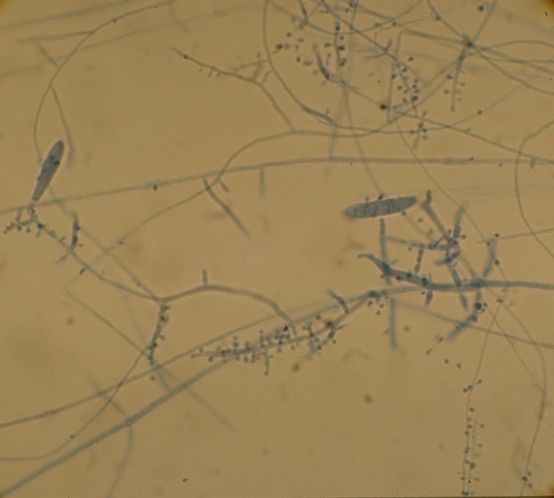 Microbiología y Epidemiología: Trichophyton rubrum. Trichophyton ...