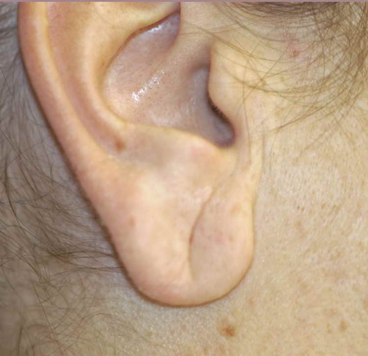 Your Ears Surprisingly Reveal A Lot About Your Personality ~ NEWSOLOGYS