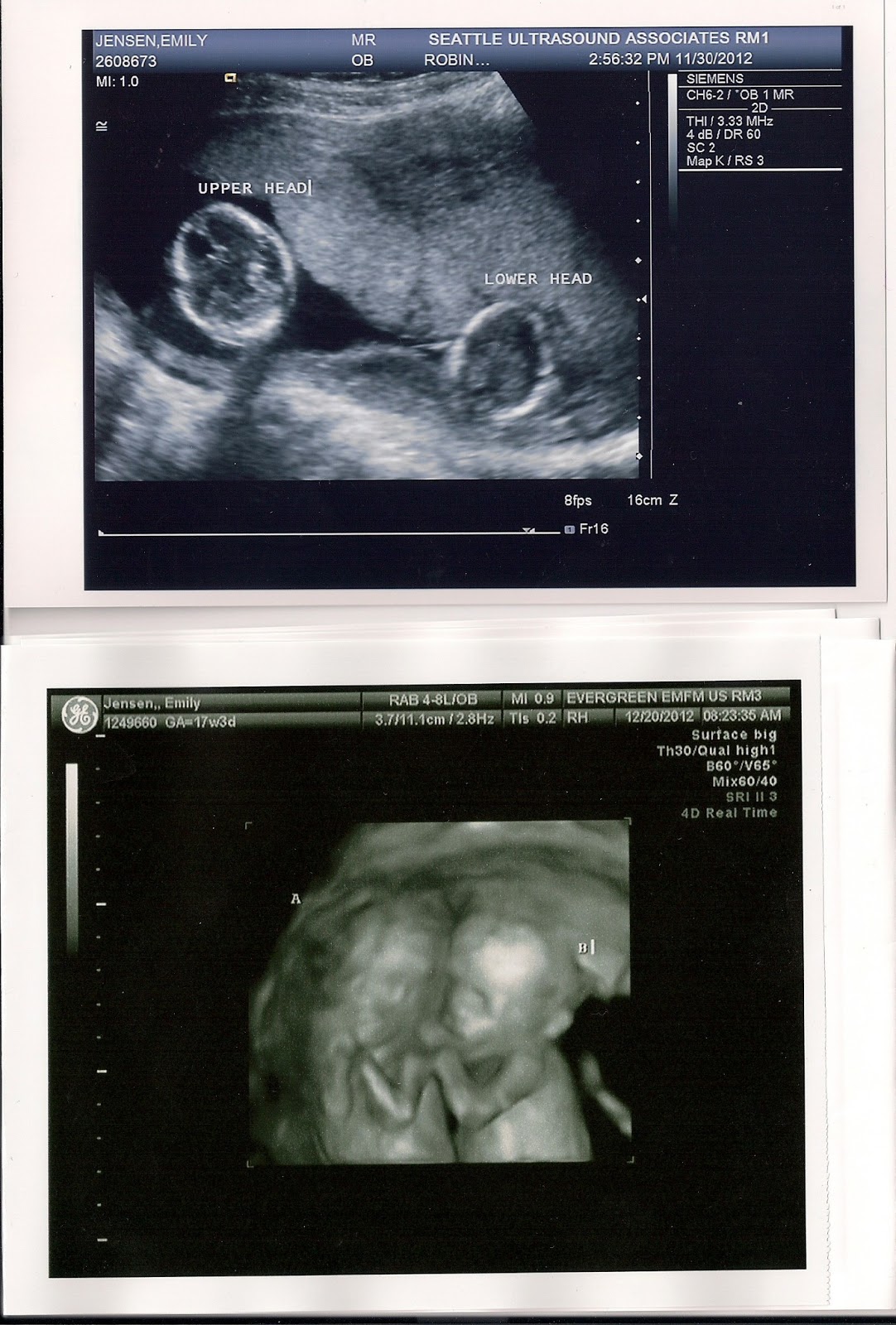 The Hadley House: Identical Twin Boys!!!!