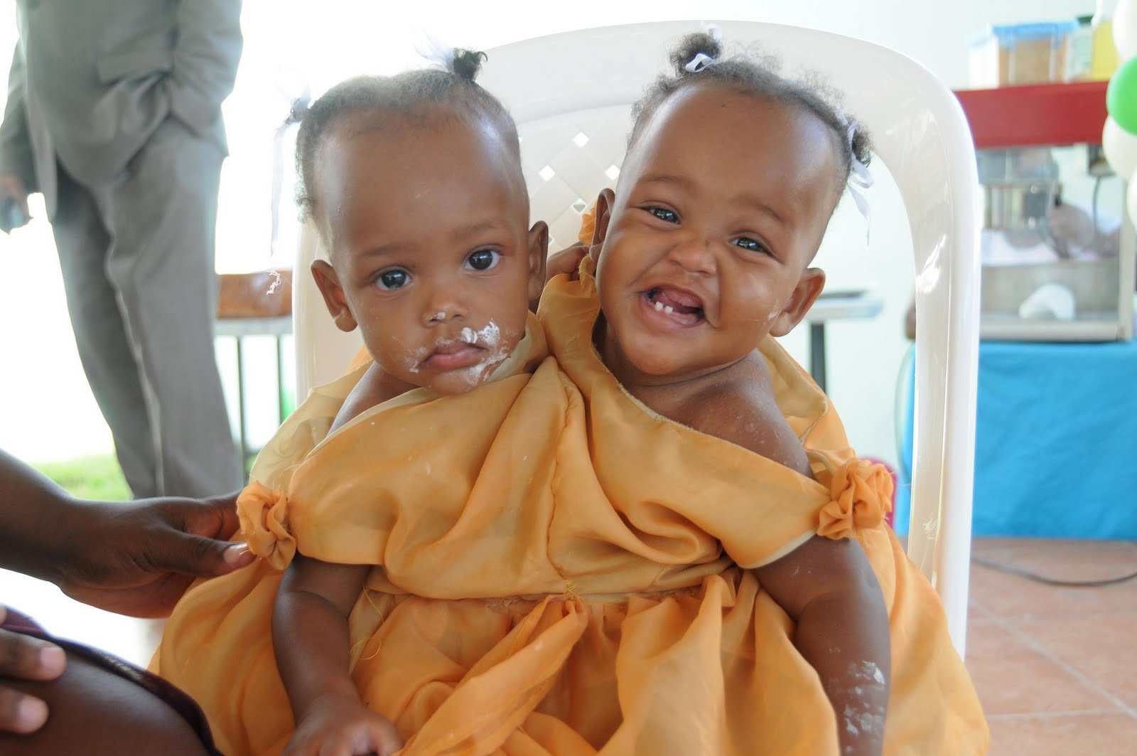 Siamesas viajarán a EE.UU. para que médicos evalúen su separación