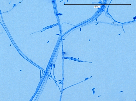 Fun With Microbiology (What's Buggin' You?): Sarocladium kiliense