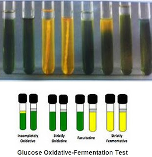 Oxidation-Fermentation (OF) Test (or Hugh-Leifson Test) - Microbiology ...
