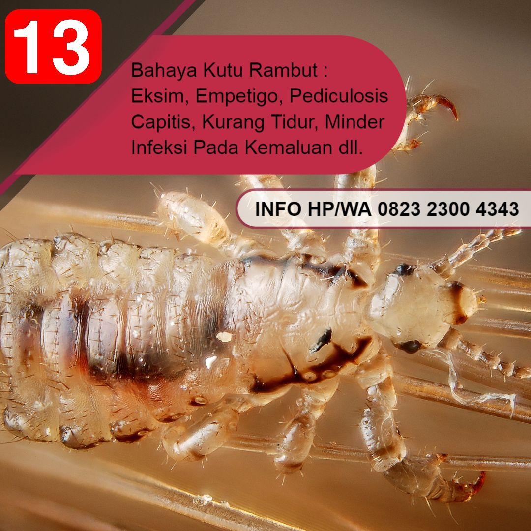 cara menghilangkan kutu rambut dan telurnya secara alami tanpa merusak ...
