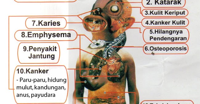 Rokok punca penyakit kronik ~ seribupilihan