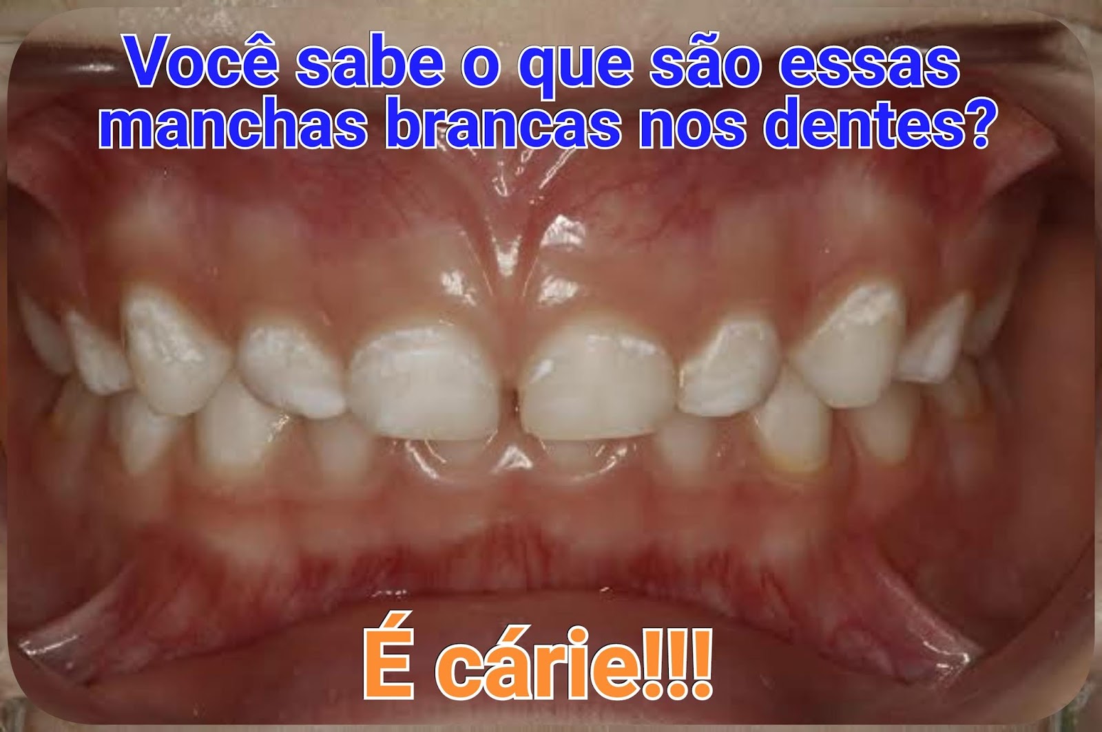 BARRIGUDA NEWS - UM ESPAÇO PLURAL E DEMOCRÁTICO: DRA. PALOMA CAVALCANTE ...