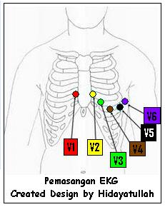 Noerdjanto, S.kep: Elektrokardiografi (EKG)