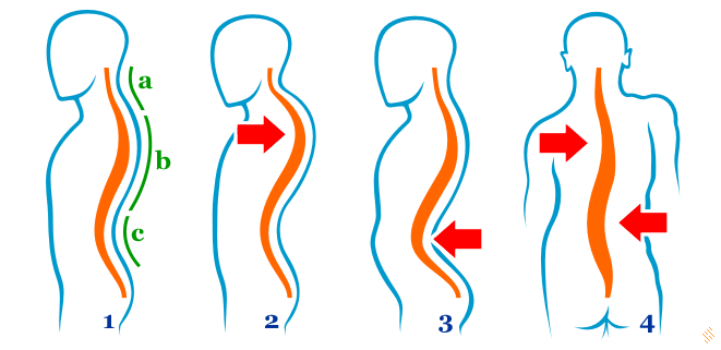 BEST MASAJ.ro: Exercitii pentru coloana vertebrala - partea 1