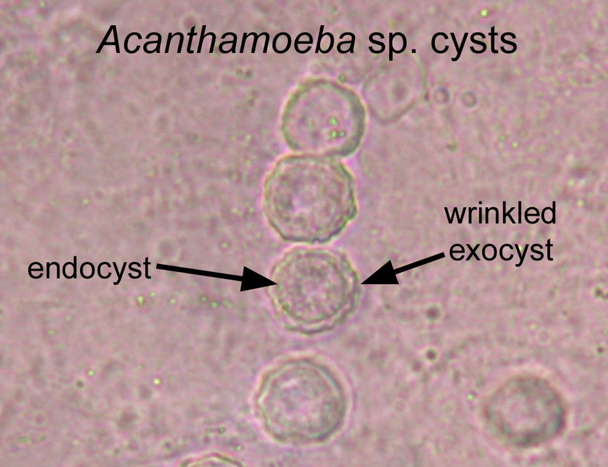 Creepy Dreadful Wonderful Parasites: 2012