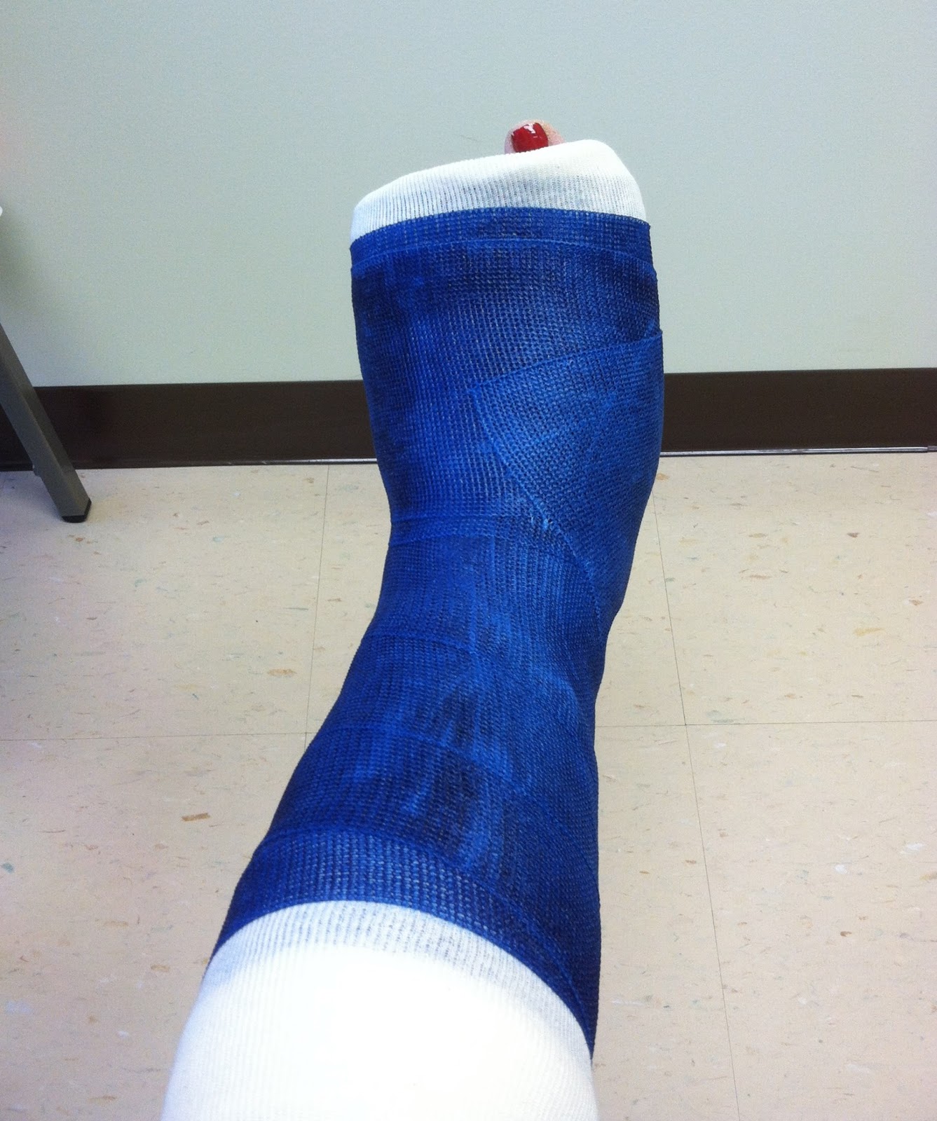 Amy Can't Run: What the heck is Compartment Syndrome, anyway???