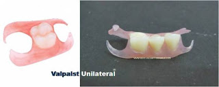 Valplast (gigi tiruan lepasan) ~ Dentana and Dentina