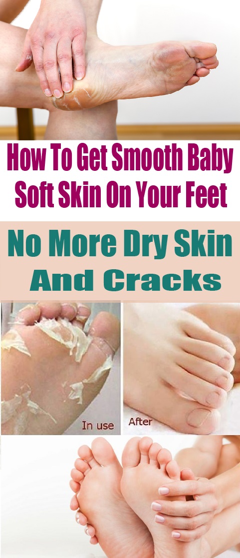 How To Get Smooth Baby Soft Skin On Your Feet, No More Dry Skin And ...