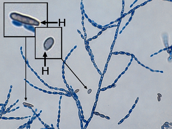 Fun With Microbiology (What's Buggin' You?): Cladophialophora species