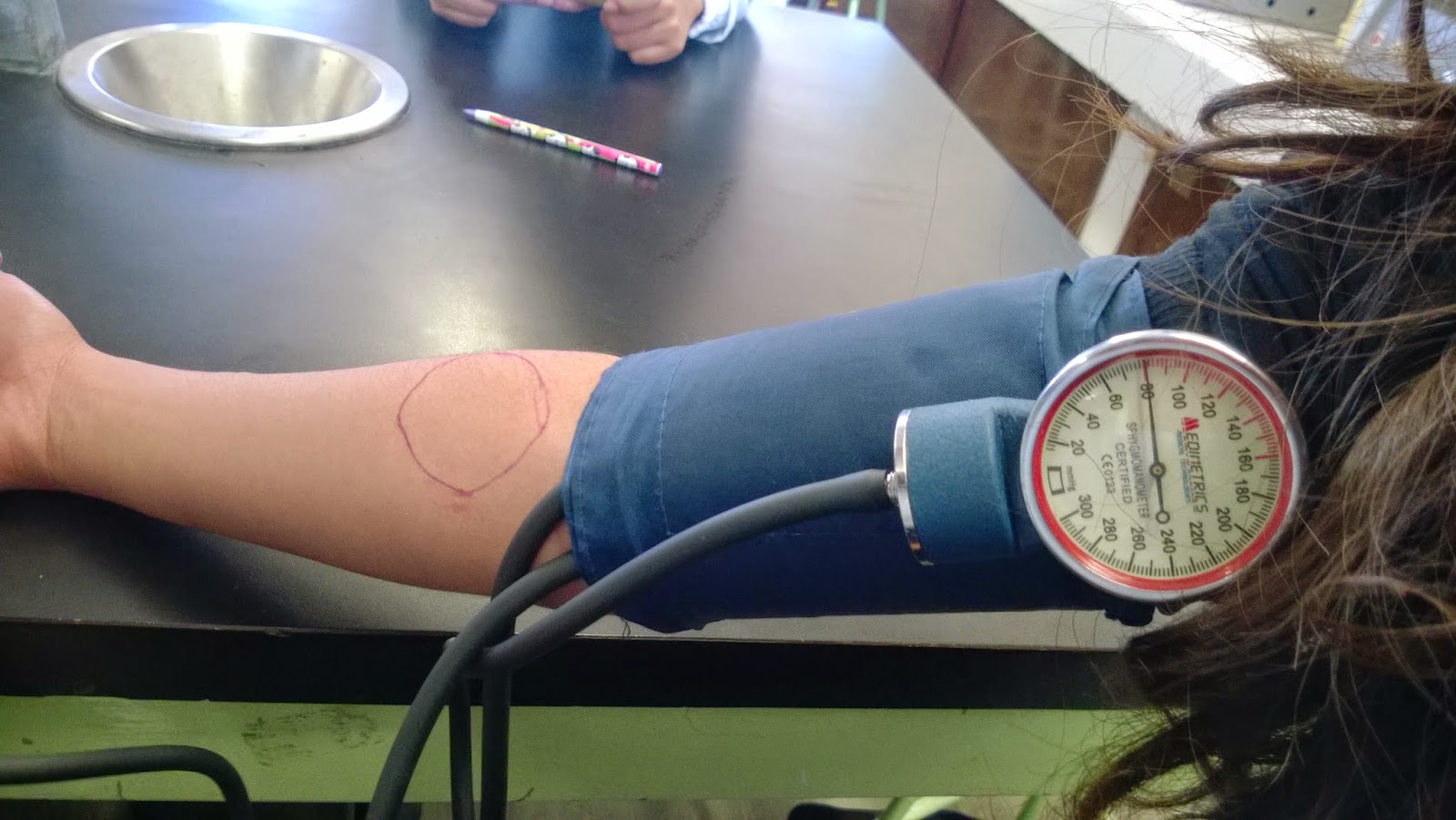 PRUEBA DE RUMPEL-LEE: PRUEBA DE RUMPEL-LEEDE