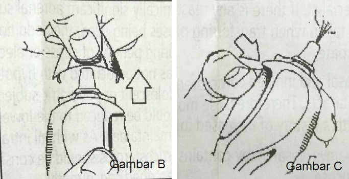 Cara Menggunakan Obat Semprot Hidung Avamys dengan Benar - ydhartono.com