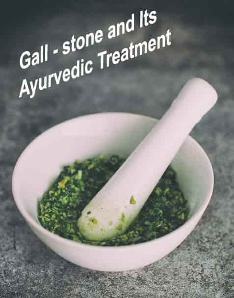 Gall - stone and Its Ayurvedic Treatment - All Health Clue