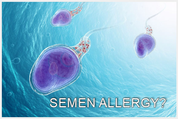 Bacterial Vaginosis Freedom How To Know If Youre Allergic To Semen