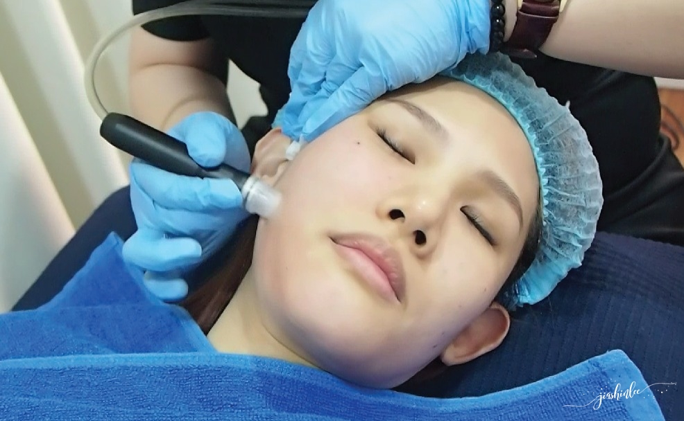 Medical Facial at One Doc Medical Laser & Aesthetic - Jia Shin Lee