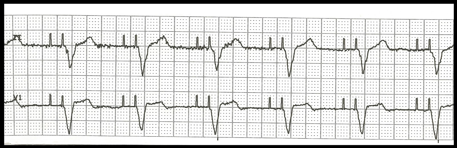 Basic EKG Rhythm Test 01
