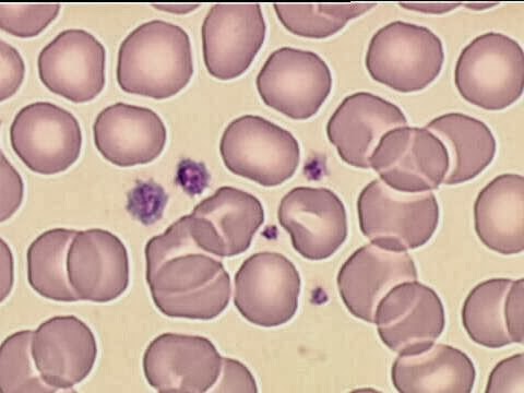 Diamond de paradis: cours de hematologie: les plaquettes