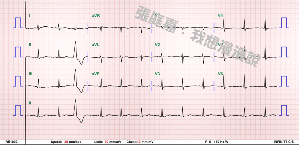 傻傻分不清楚：VPC還是APC？