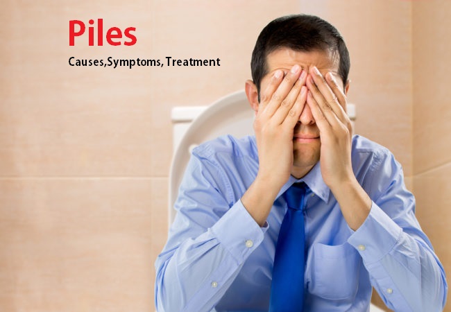 Hemorrhoids : Piles Symptoms, causes, and treatments