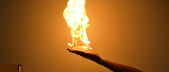 SainsMudah.Com: Tangan Terbakar