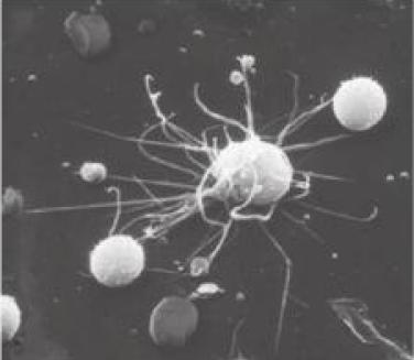 Células Dendríticas: Células Dendríticas