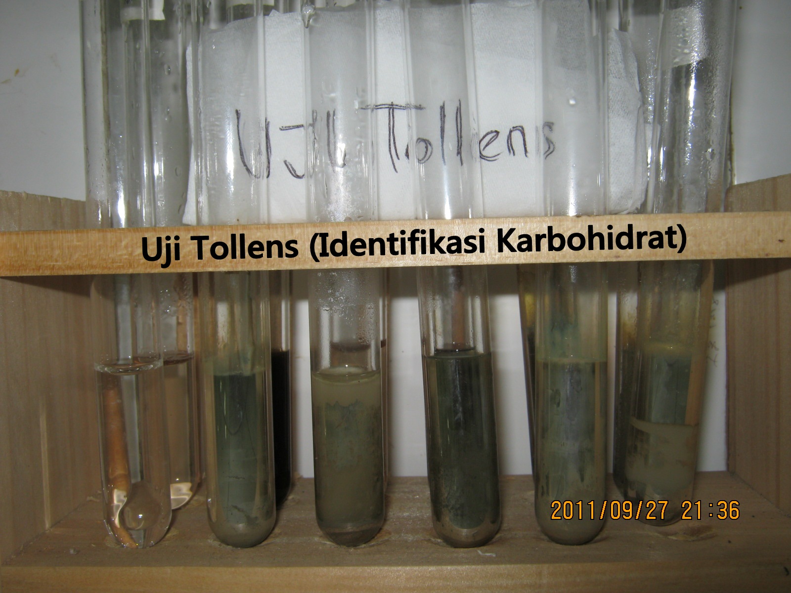 Identifikasi Karbohidrat | Analis Kesehatan