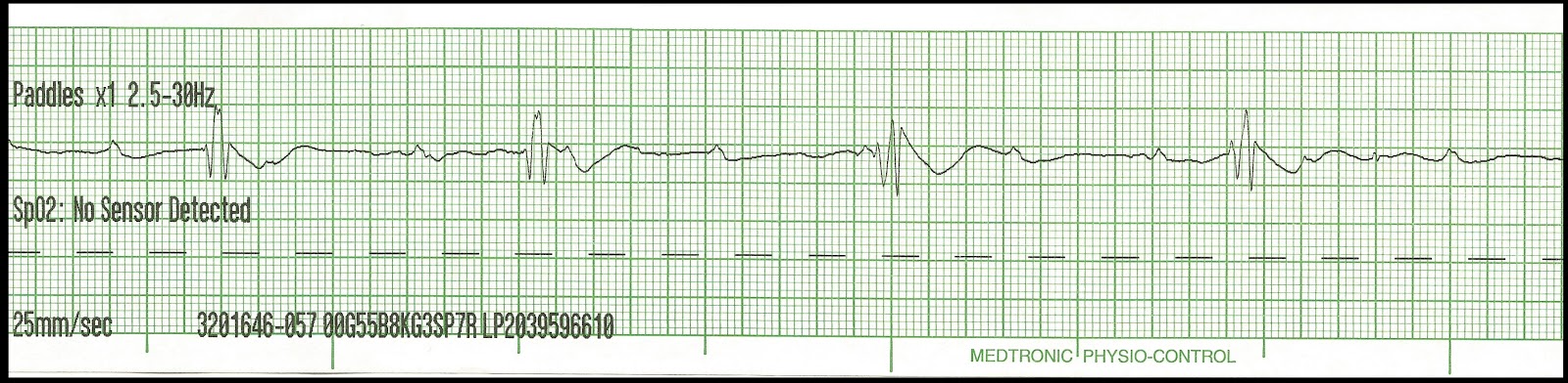 Code Blue: Shop till you drop