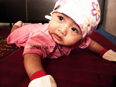 :: DEQYA's STORY ::: Nur Aira & Ekzema