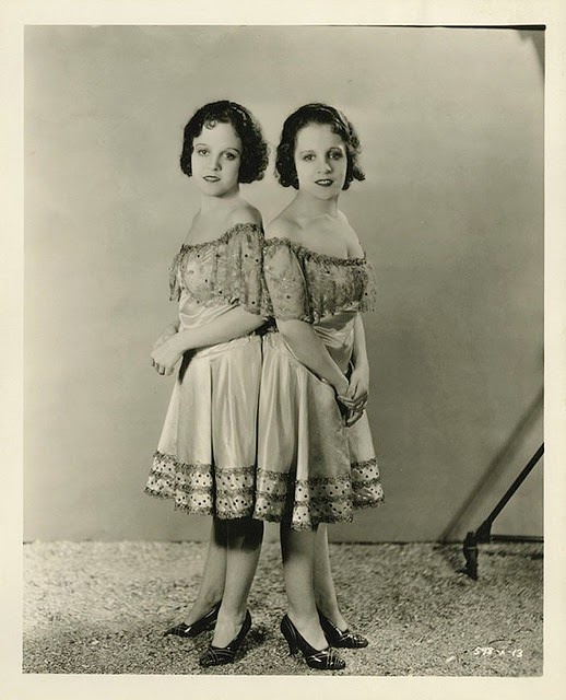 Hamilton Sisters Siamese Twins