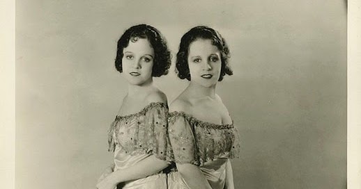 Hamilton Sisters Siamese Twins