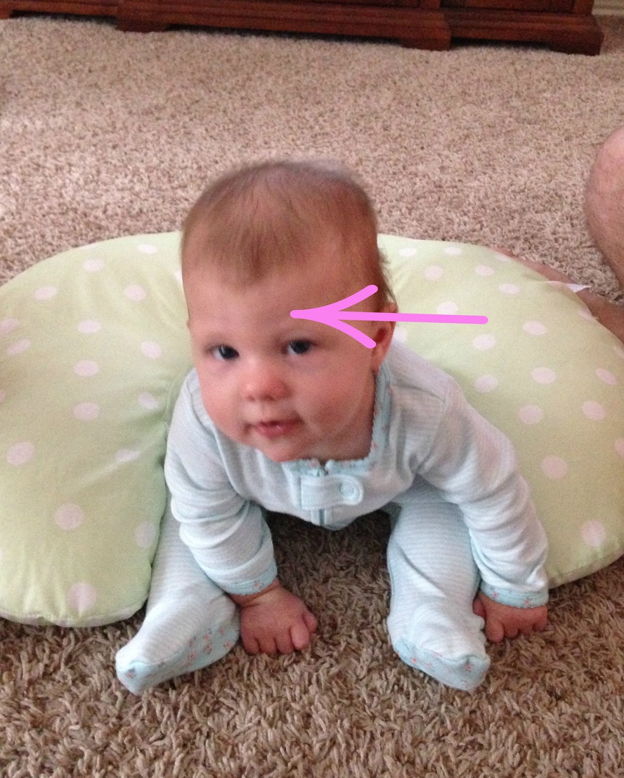 Our Life Together: Trigonocephaly