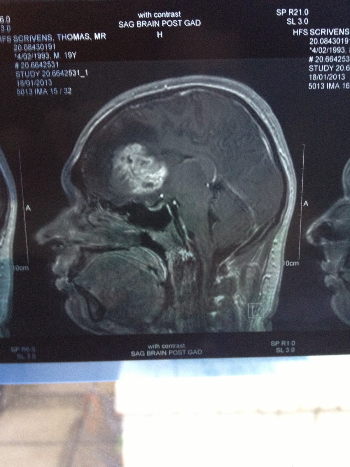Chapter 5 MRI Scans & Hospital