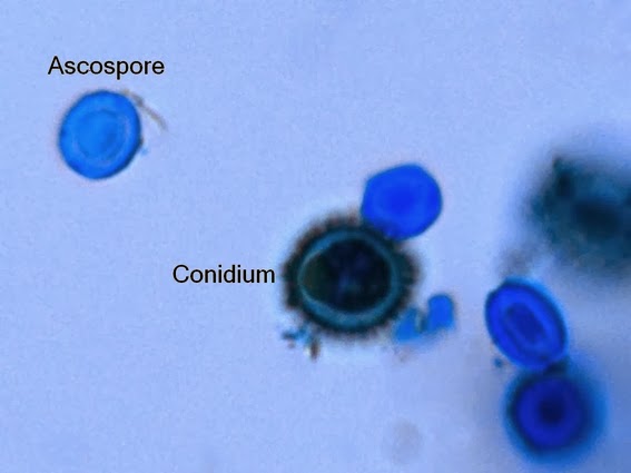Fun With Microbiology (What's Buggin' You?): Eurotium herbariorum ...