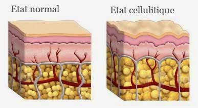Ebooks Gratuits: Comment Se Débarrasser De La Cellulite