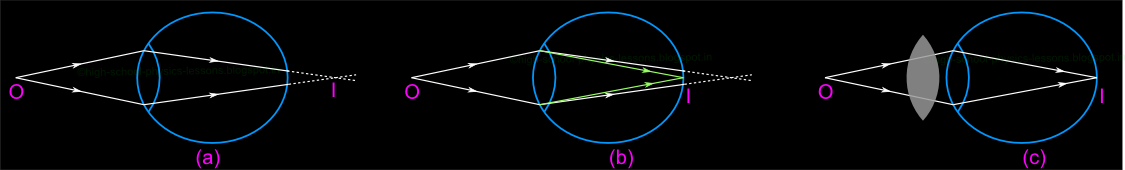 High school Physics Lessons: Chapter 7.5 - Eye and Vision