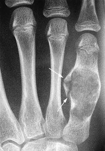 EL RINCÓN DE LA MEDICINA INTERNA: 9 oct 2018