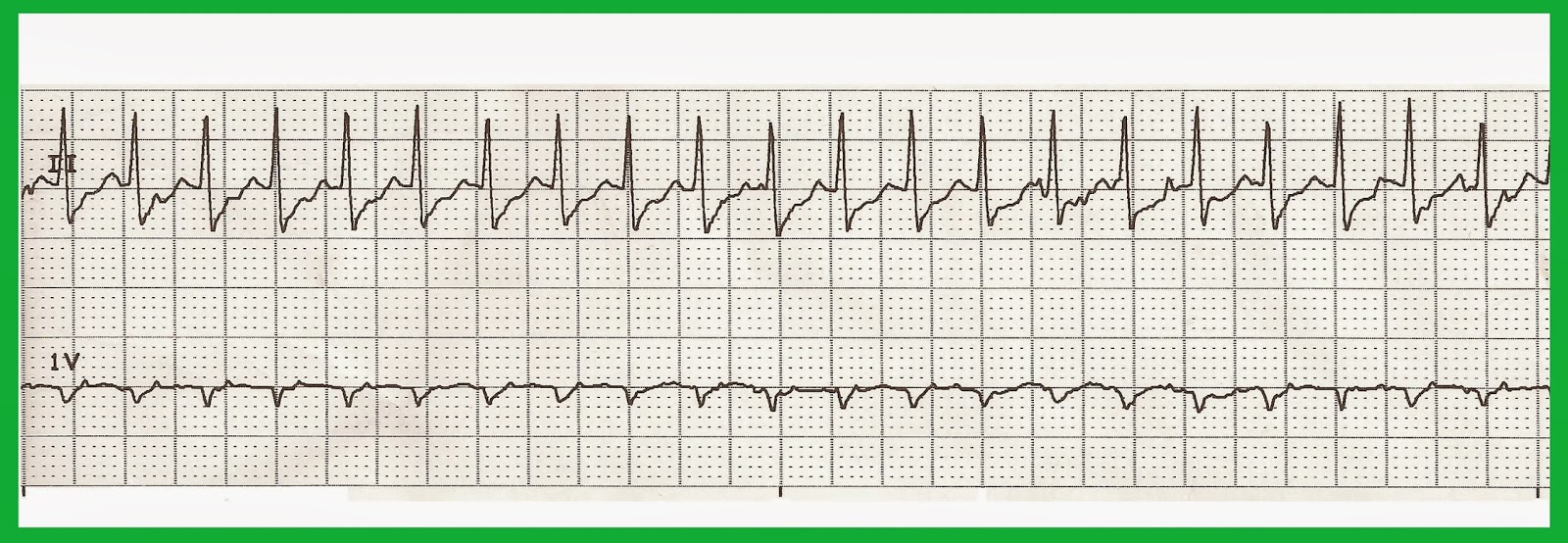 Practice EKG Rhythm Strips 209