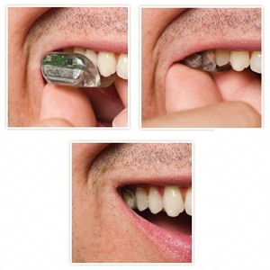 Above the Cloud: Molar Mic. L'auricolare-microfono che si posiziona in ...