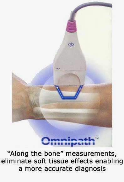 My Osteo Experience: About Bone Density Ultrasound screening tests