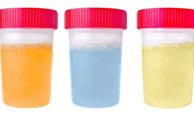 Urin Dan Kesihatan, Ini Dia 7 Warna Urin Yang Boleh Menceritakan ...