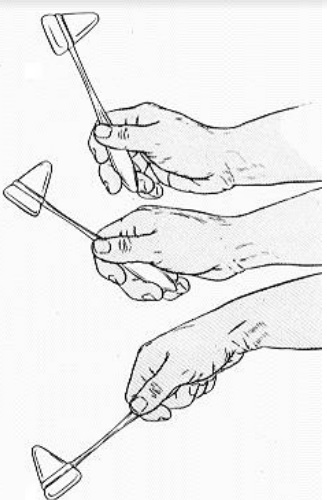 Refleks Nedir? Refleks Çeşitleri Nelerdir ve Refleks Muayenesi Nasıl ...