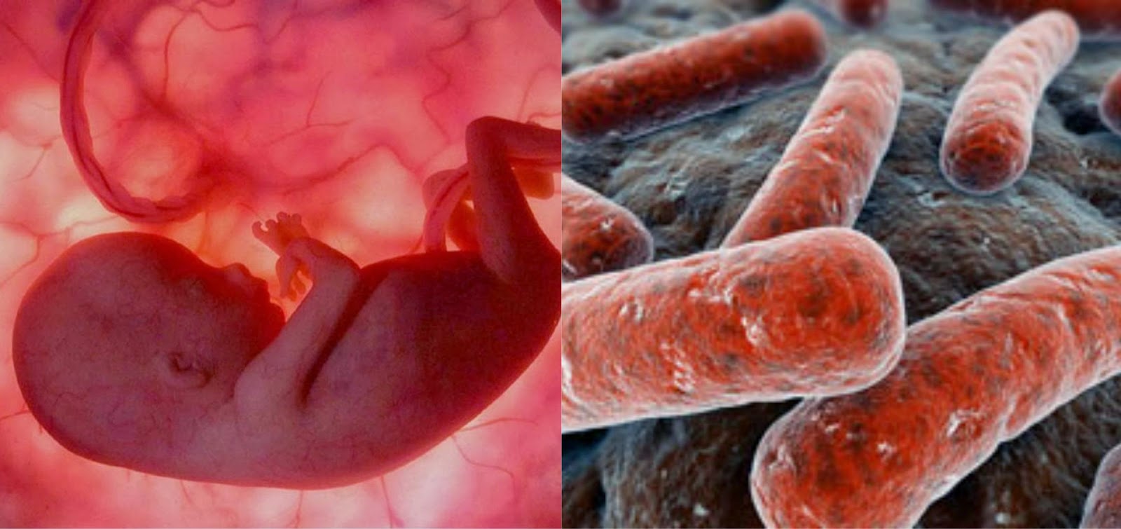 Consultoria de Enfermagem Mendes & Hernandez: Tuberculose no Brasil