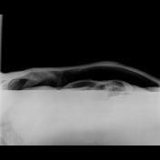 X-RAY ABDOMEN DORSAL DECUBITUS