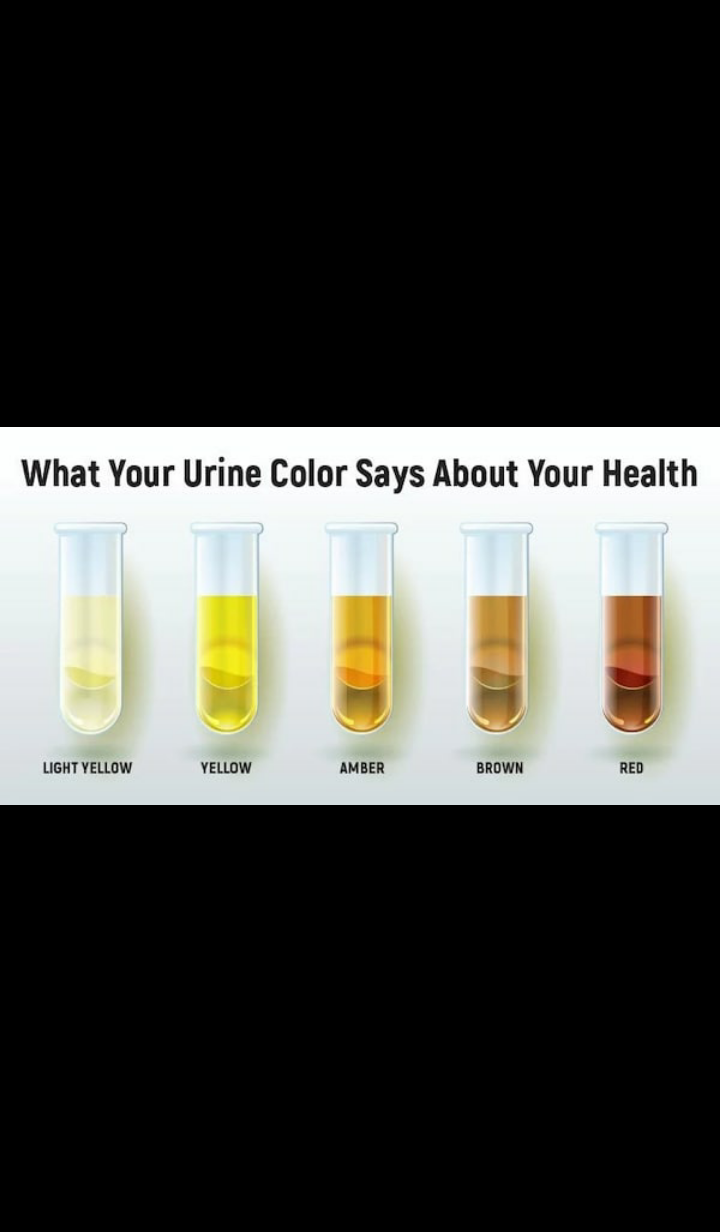 8 Urine Colors and what each say about your health
