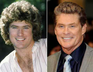 Has David Hasselhoff had Plastic Surgery Before and After Botox ...