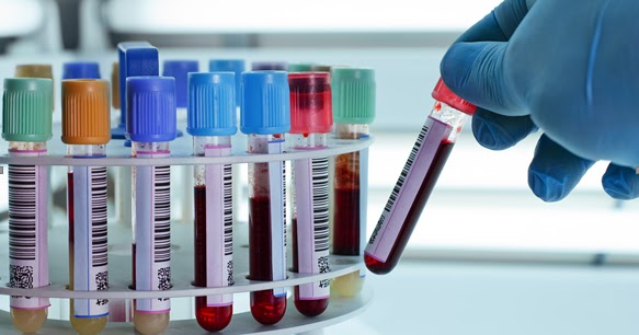 4 TYPES OF GENETIC TESTING